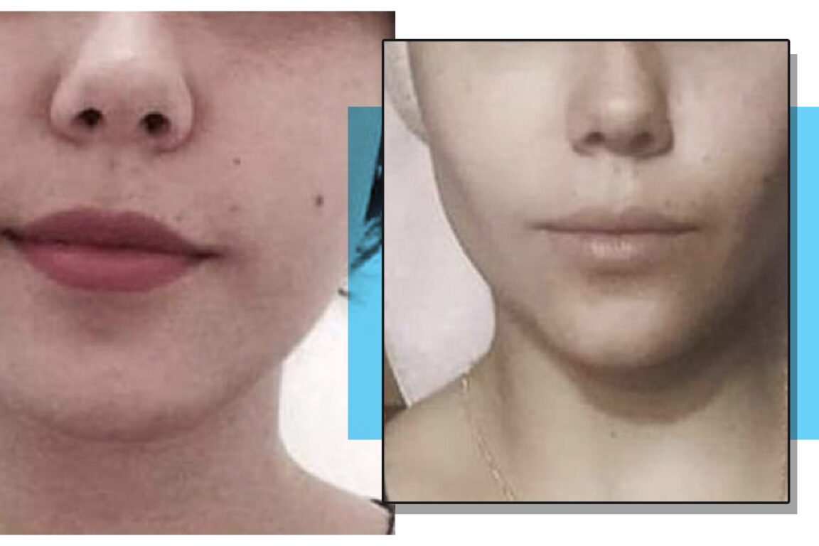ΠΛΑΣΤΙΚΗ ΧΕΙΡΟΥΡΓΙΚΗ – Sofia D. Parlavantza MD MSc